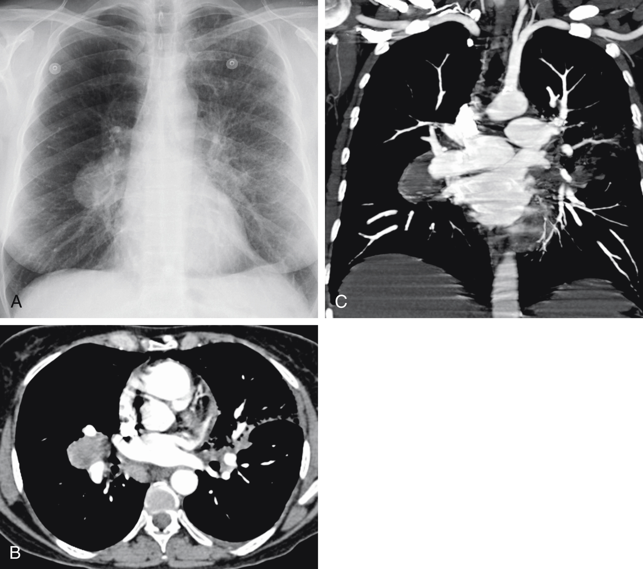 Chest Radiology