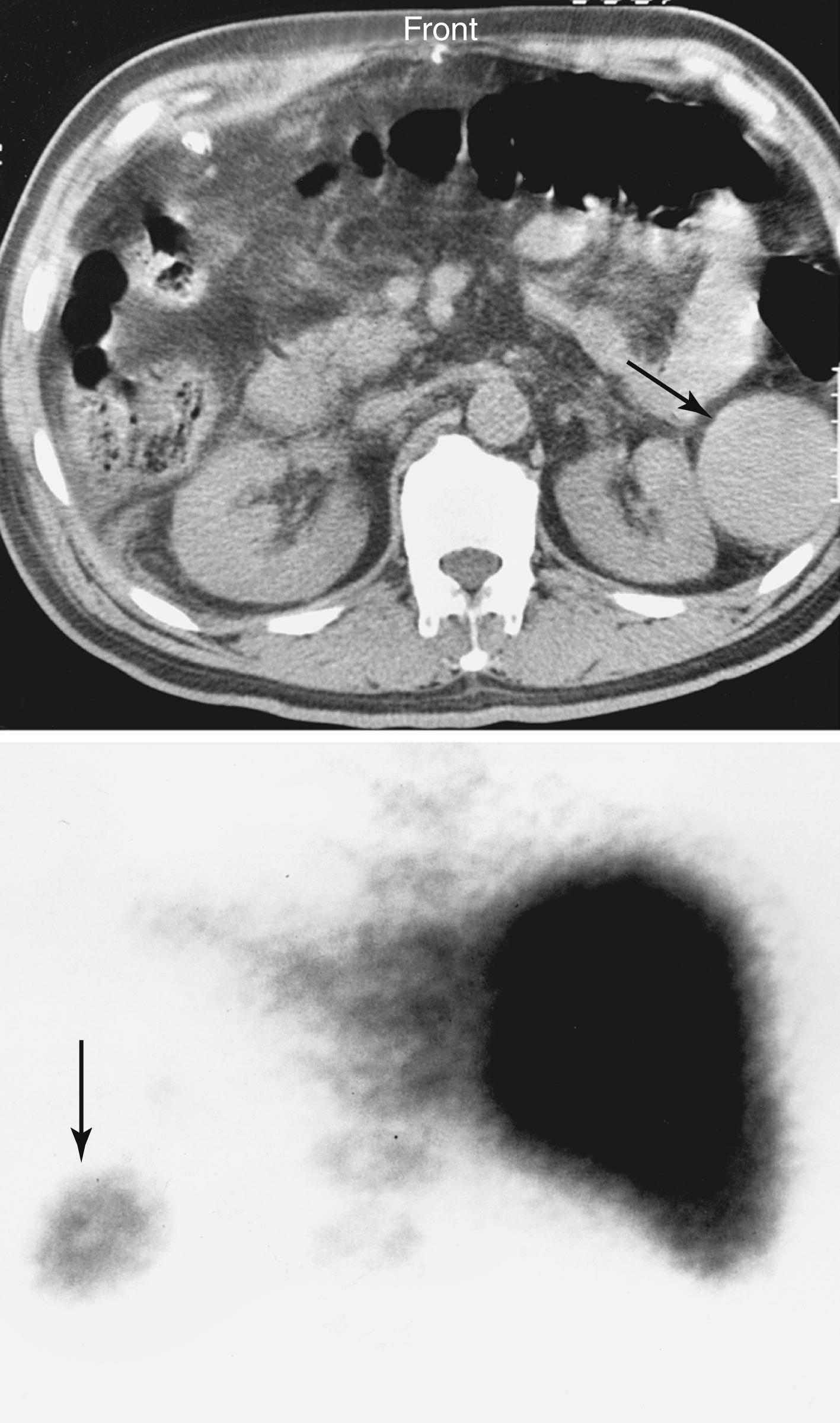 Essentials of Nuclear Medicine Imaging