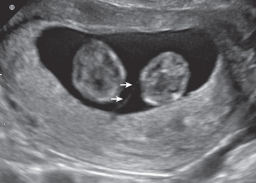 Obstetric Imaging