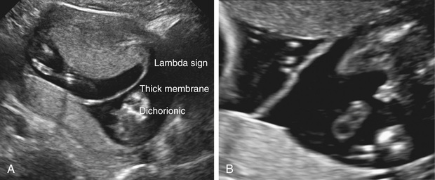 Obstetric Imaging