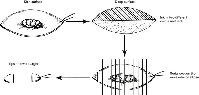 Manual of Surgical Pathology