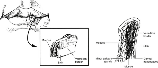 Manual of Surgical Pathology