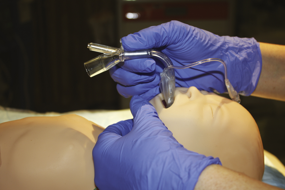 Assisted Ventilation of the Neonate