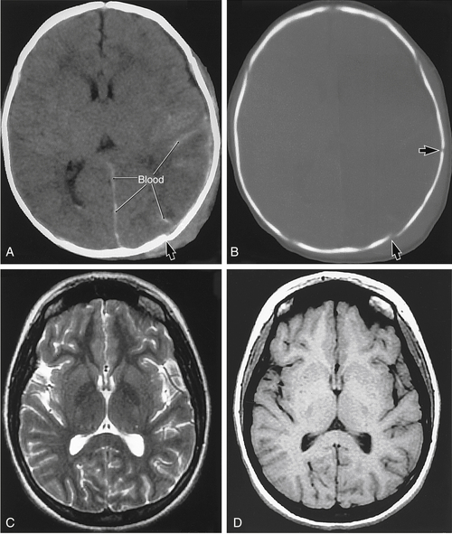 Neurology for the Speech-Language Pathologist