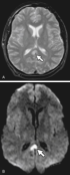 Neurology for the Speech-Language Pathologist