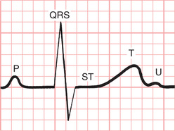 Goldberger's Clinical Electrocardiography
