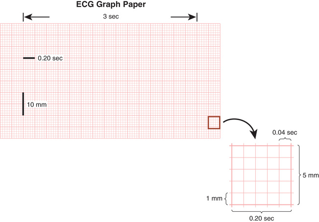 Goldberger's Clinical Electrocardiography