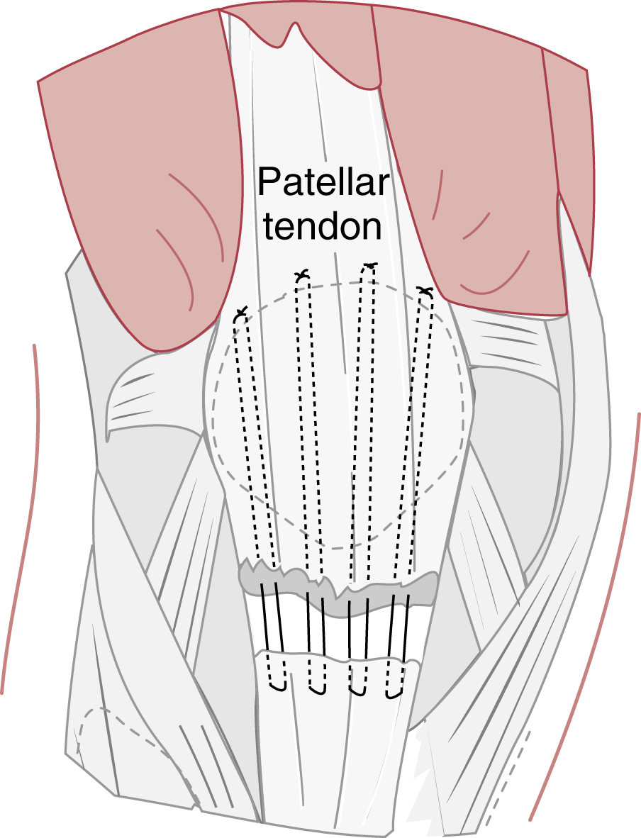 Clinical Orthopaedic Rehabilitation
