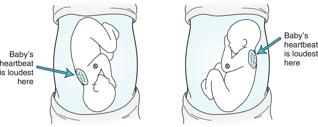 Fetal Monitoring in Practice