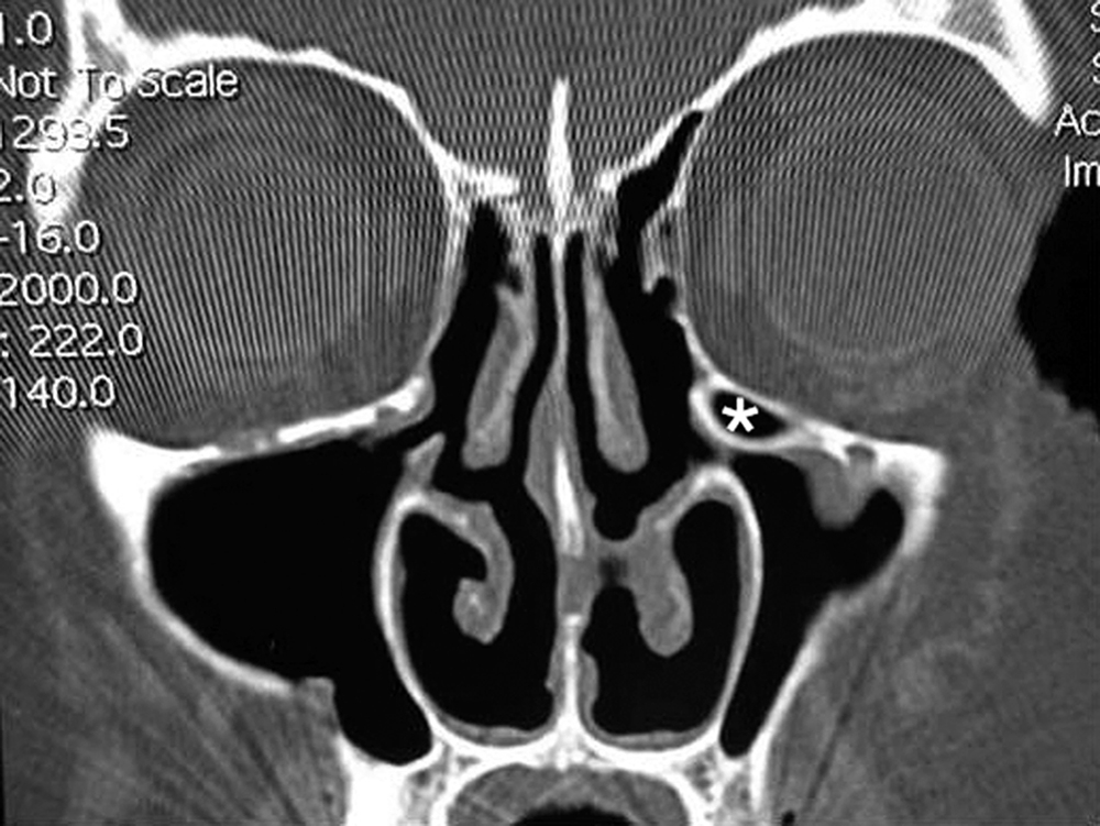 Atlas of Endoscopic Sinus and Skull Base Surgery