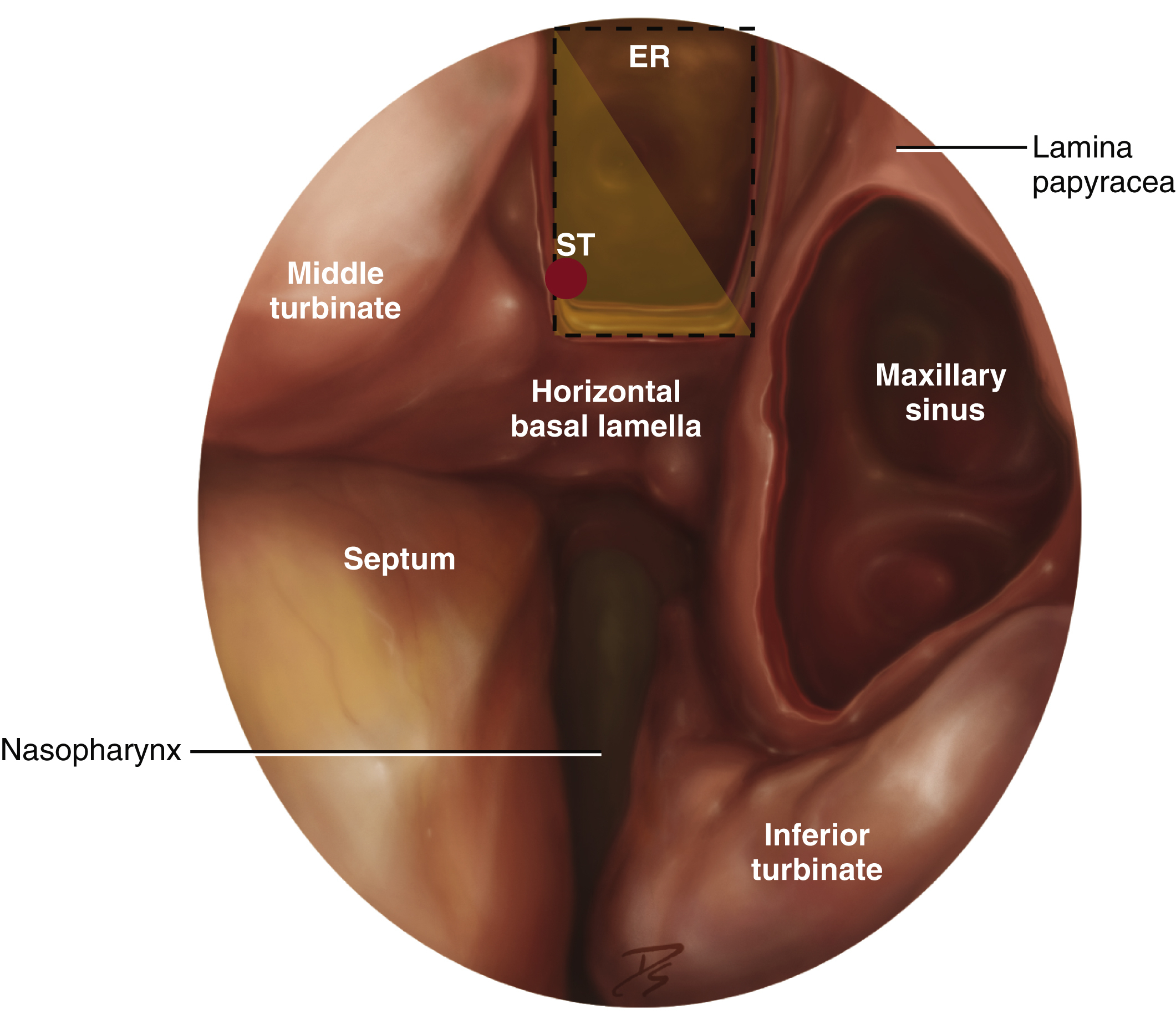 Atlas of Endoscopic Sinus and Skull Base Surgery