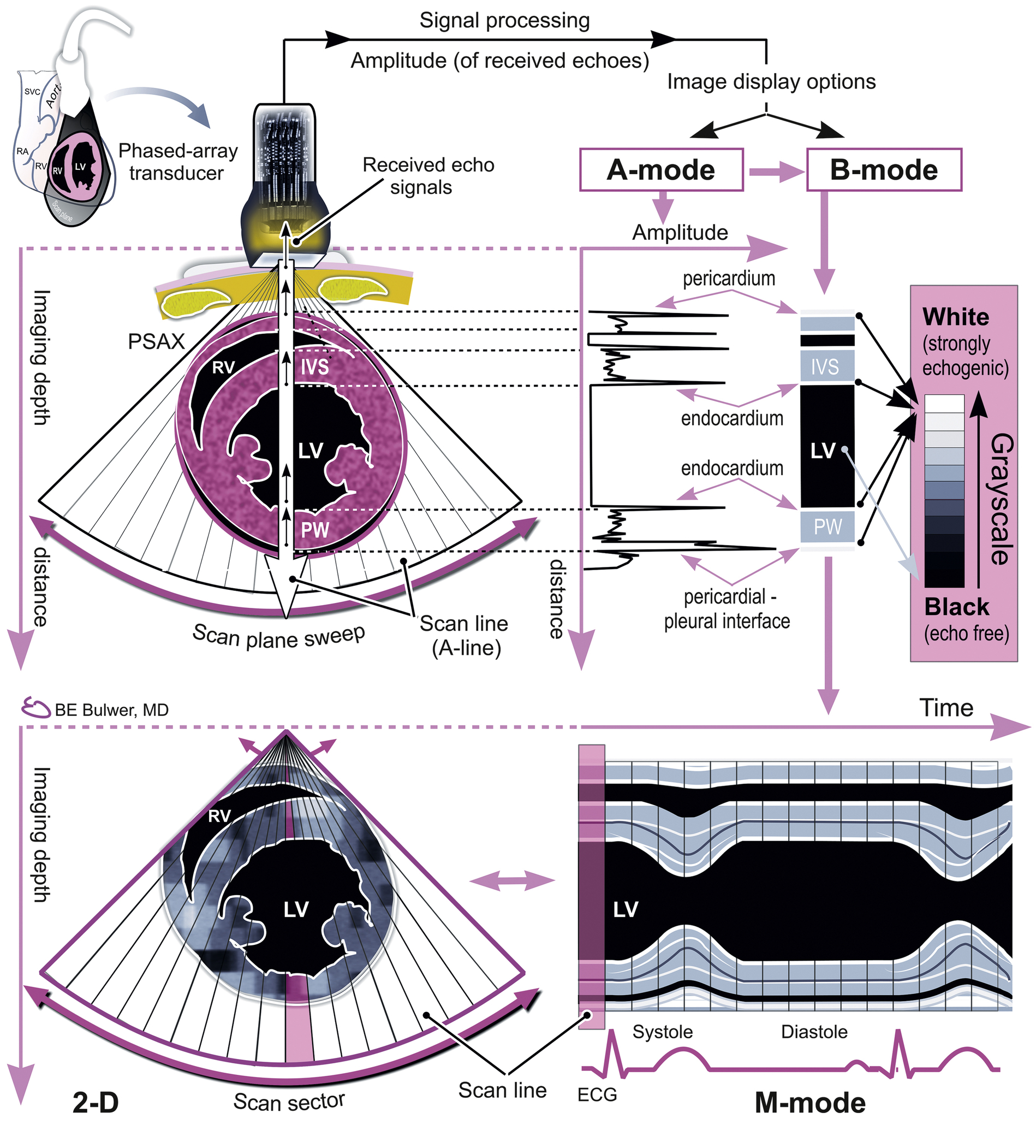 Essential Echocardiography