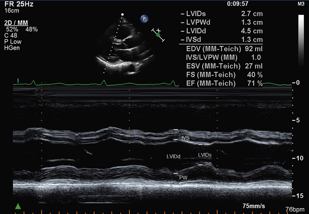 Essential Echocardiography