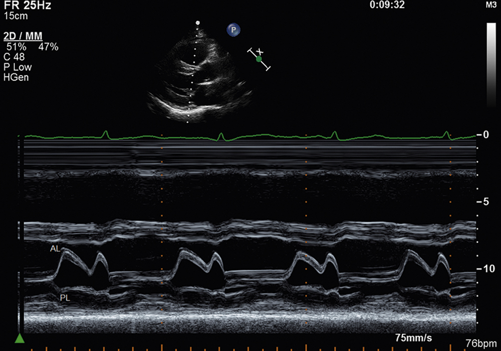 Essential Echocardiography