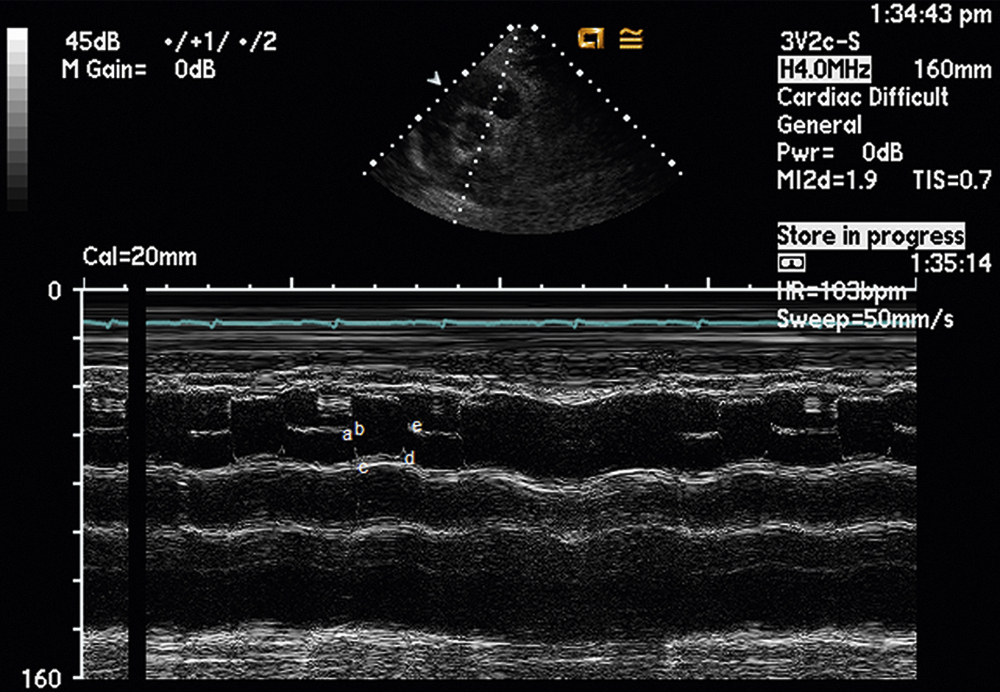 Essential Echocardiography
