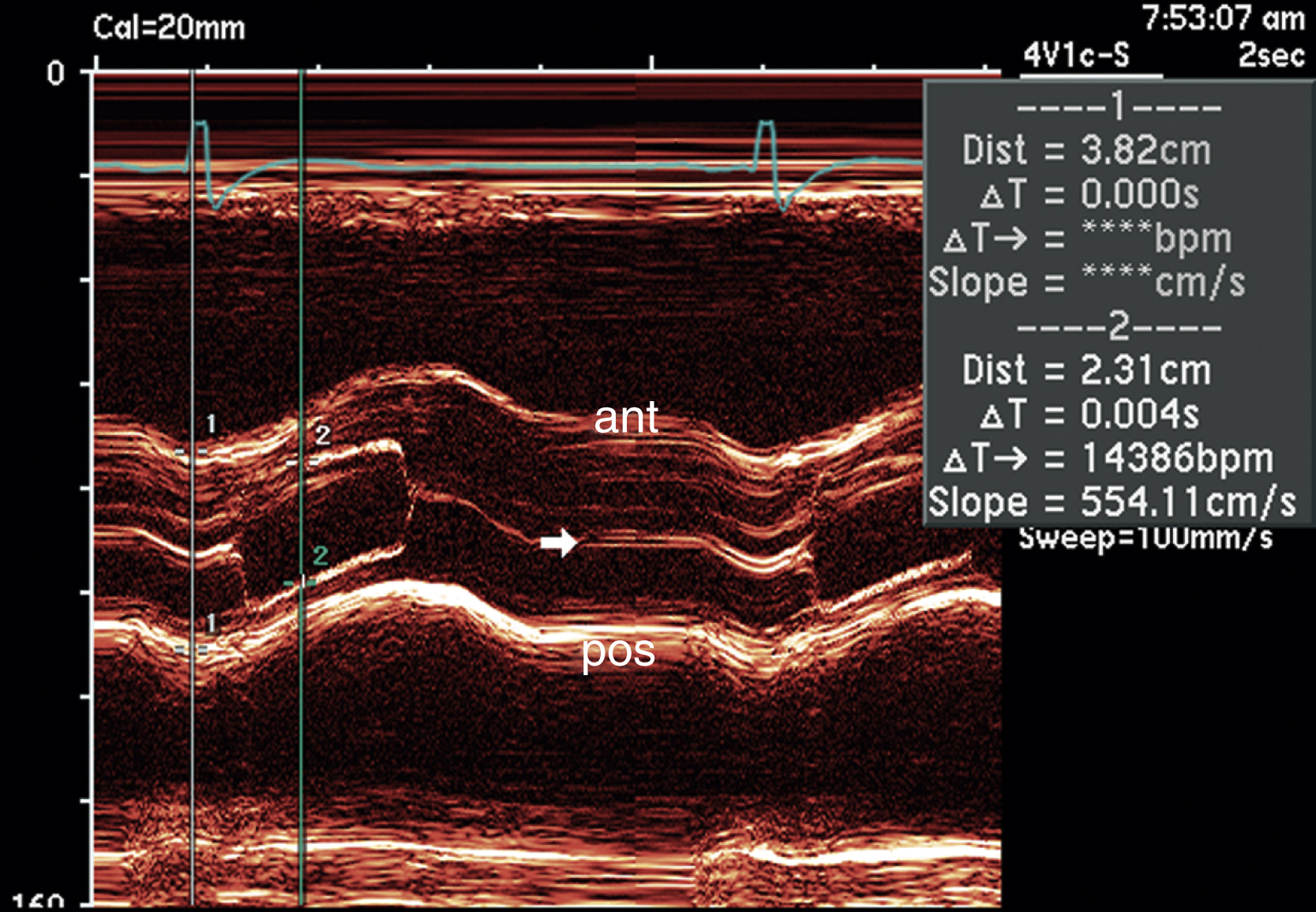 Essential Echocardiography