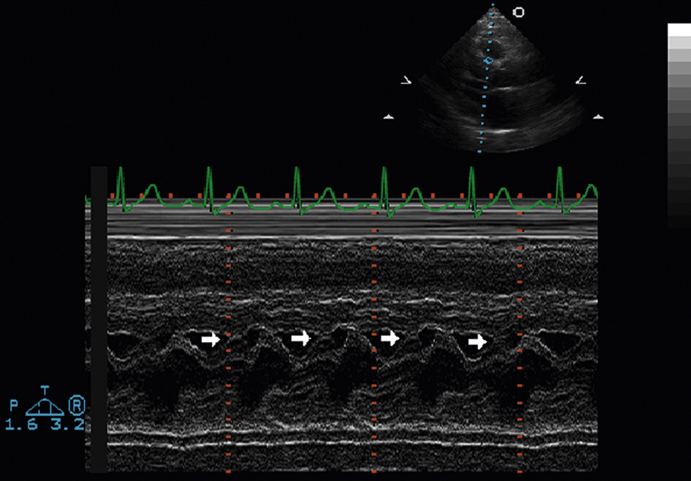 Essential Echocardiography