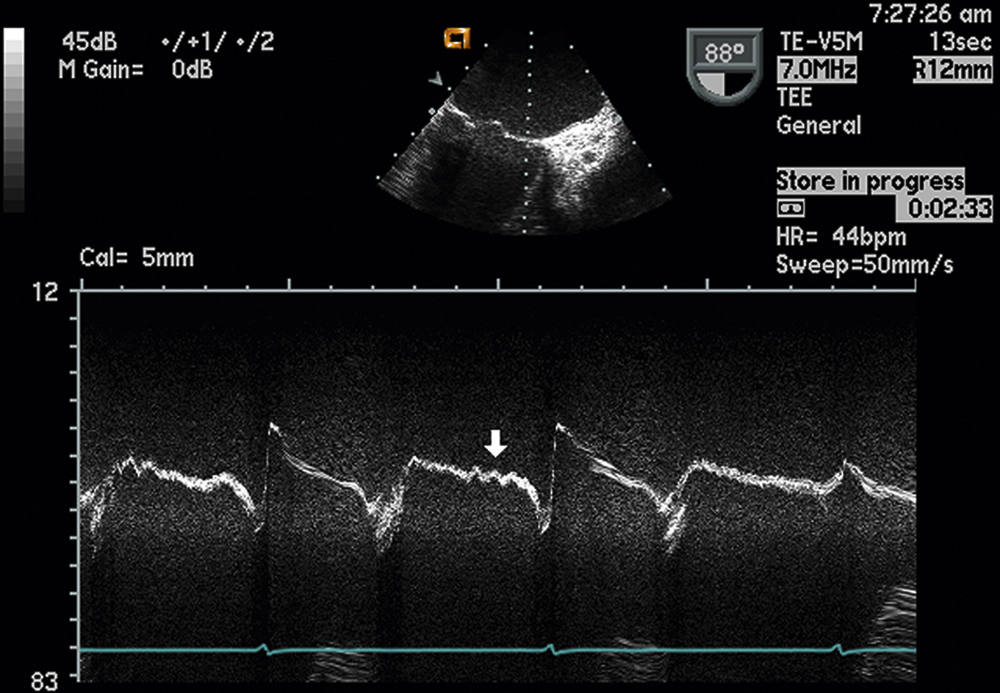 Essential Echocardiography