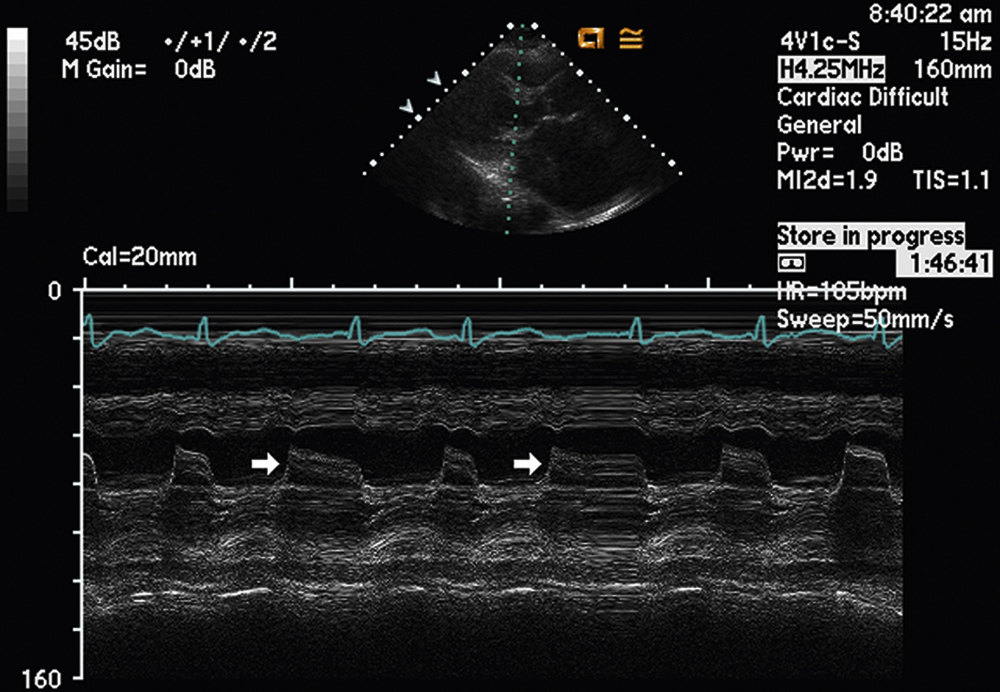 Essential Echocardiography