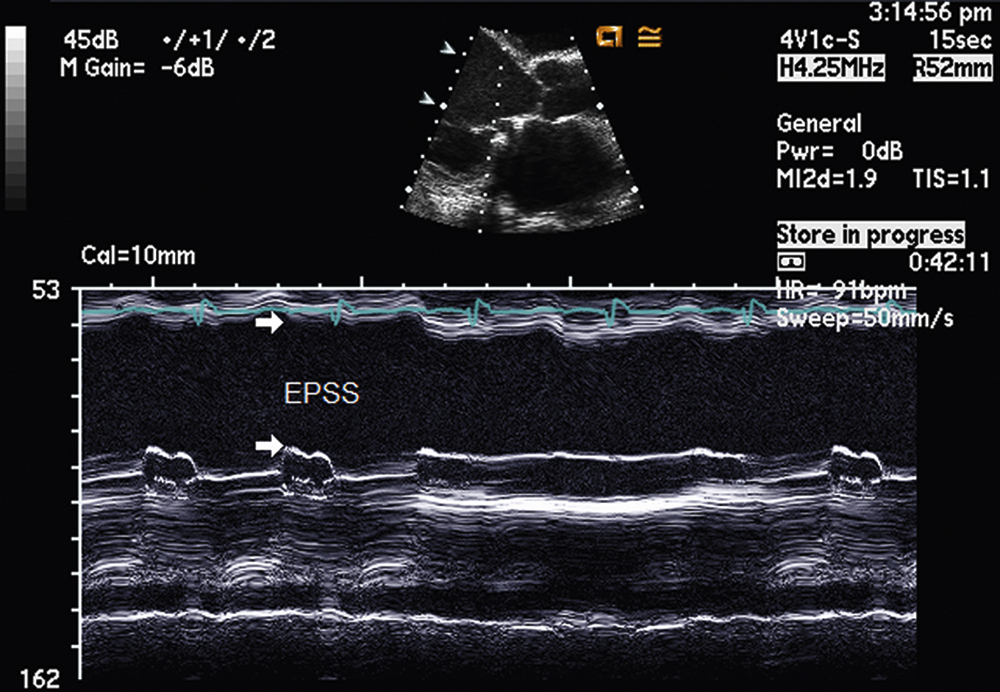 Essential Echocardiography