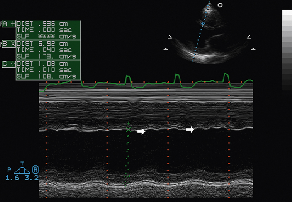 Essential Echocardiography