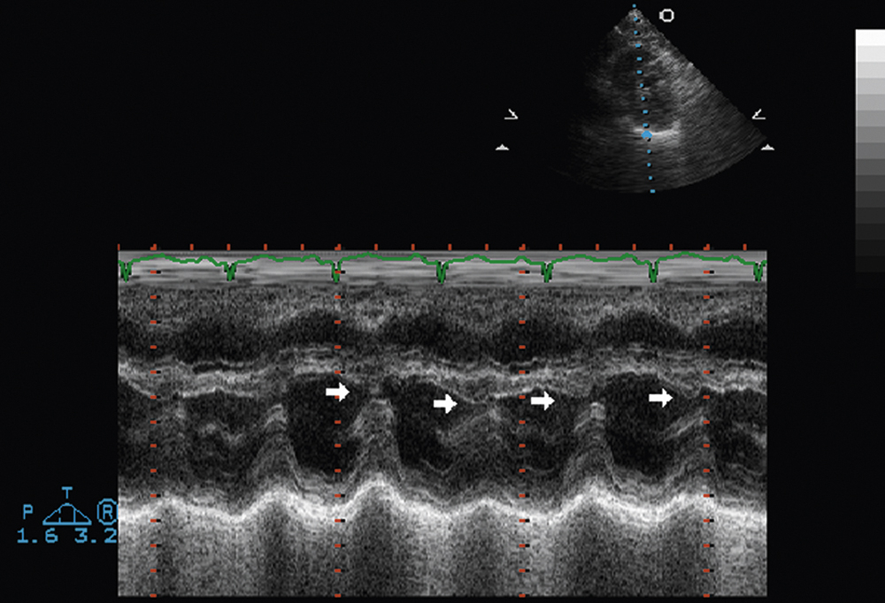 Essential Echocardiography