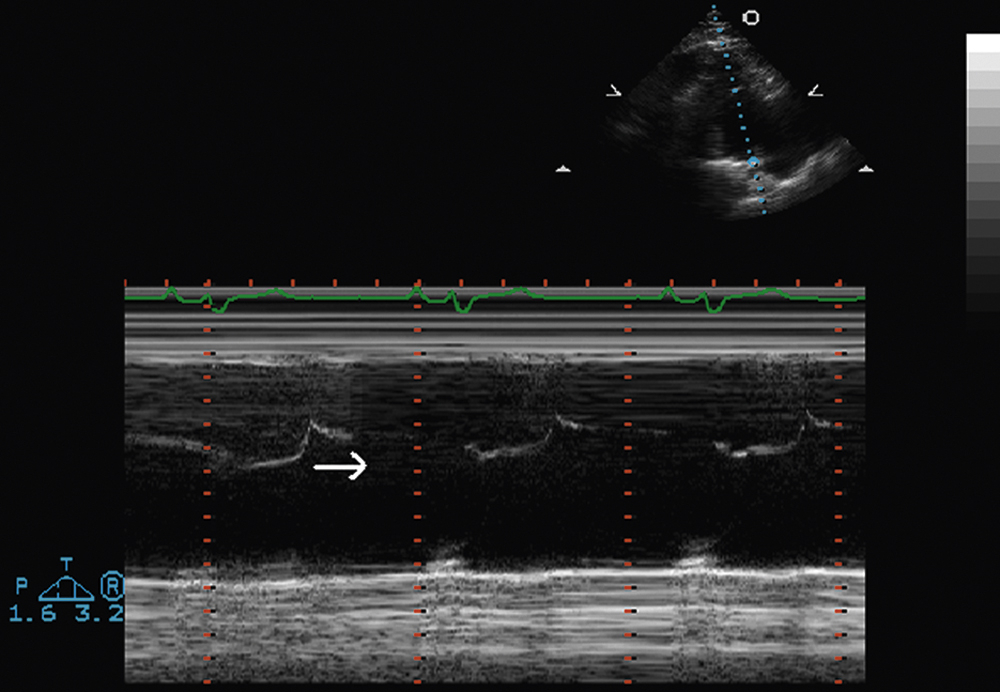 Essential Echocardiography