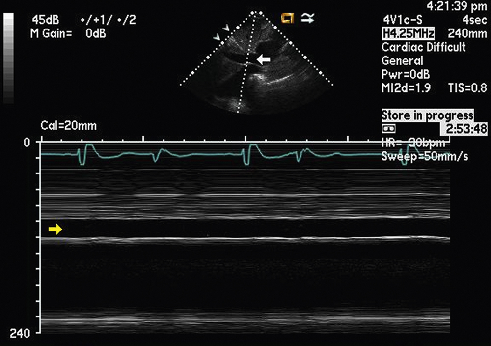 Essential Echocardiography