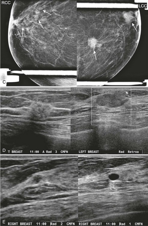 Making the Diagnosis: A Practical Guide to Breast Imaging