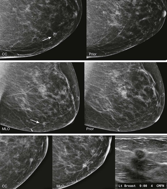 Making the Diagnosis: A Practical Guide to Breast Imaging