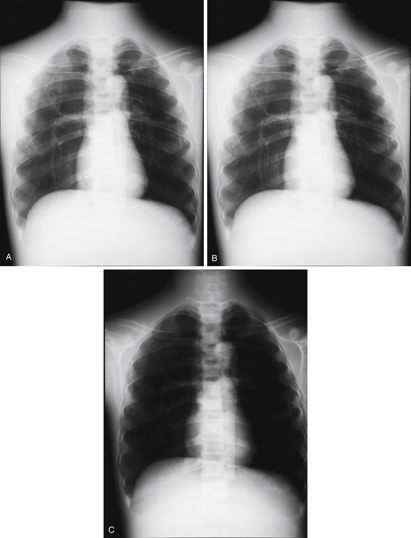 Introduction to Radiologic & Imaging Sciences & Patient Care