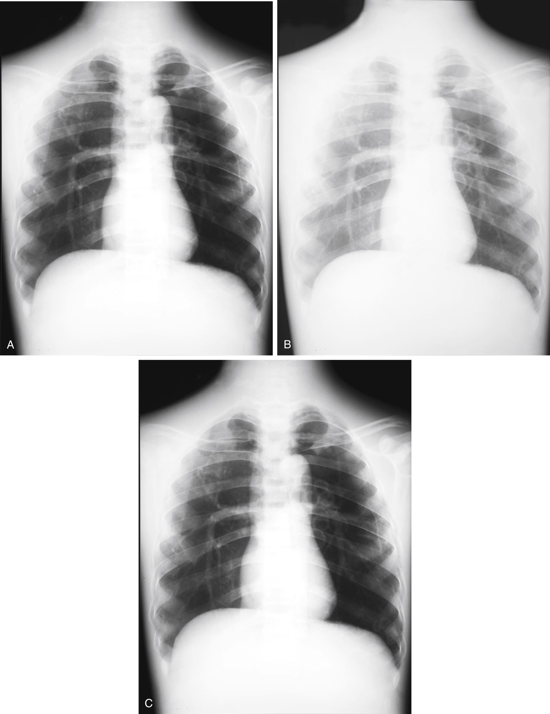 Introduction to Radiologic & Imaging Sciences & Patient Care