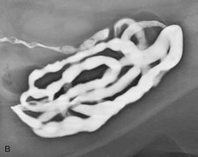 Textbook of Veterinary Diagnostic Radiology