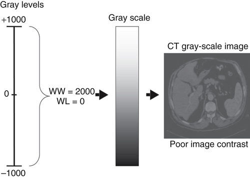 Computed Tomography