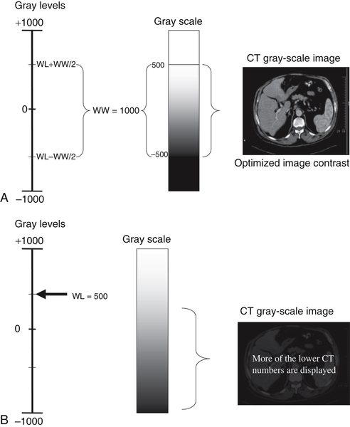 Computed Tomography