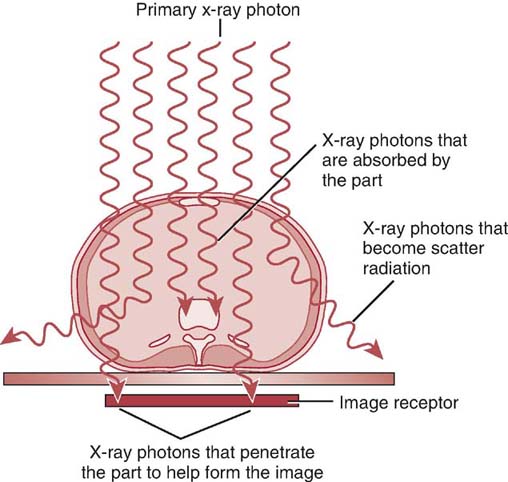 Radiographic Imaging and Exposure