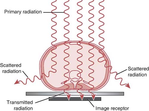 Radiographic Imaging and Exposure