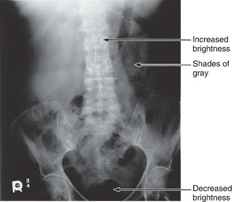 Radiographic Imaging and Exposure