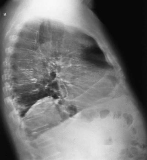 Radiographic Imaging and Exposure