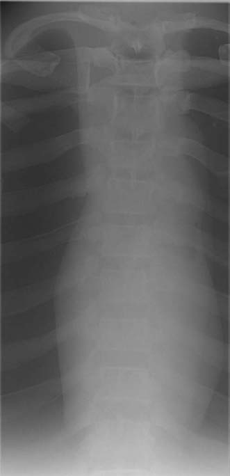 Radiographic Imaging and Exposure