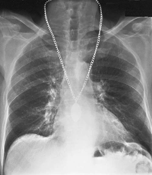 Radiographic Imaging and Exposure