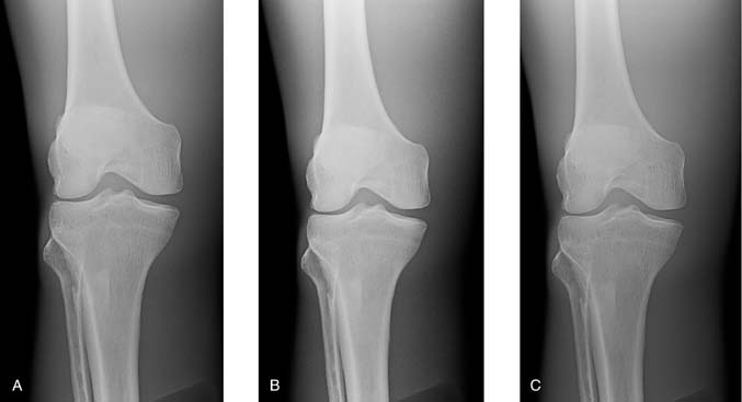 Radiographic Imaging and Exposure