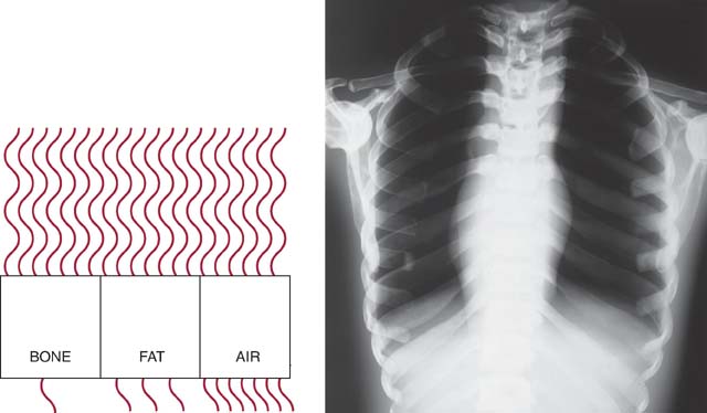 Radiographic Imaging and Exposure