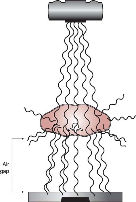 Radiographic Imaging and Exposure