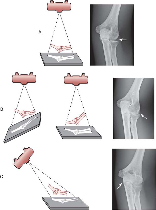 Radiographic Imaging and Exposure