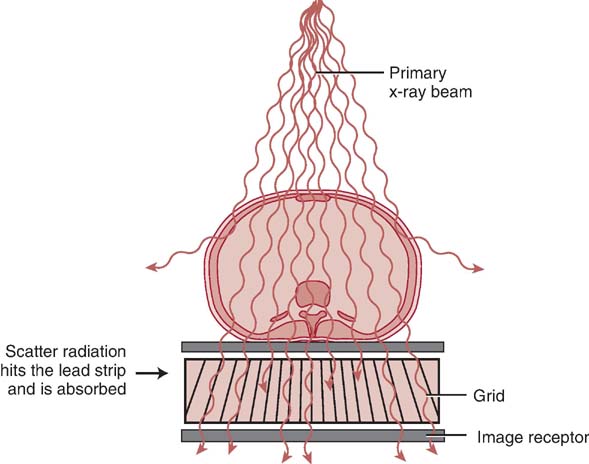 Radiographic Imaging and Exposure