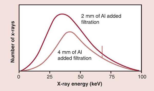 Radiographic Imaging and Exposure