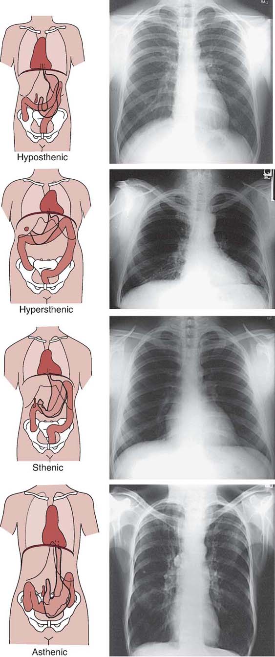 Radiographic Imaging and Exposure