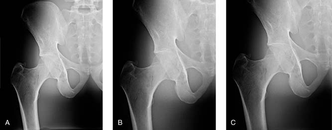 Radiographic Imaging and Exposure