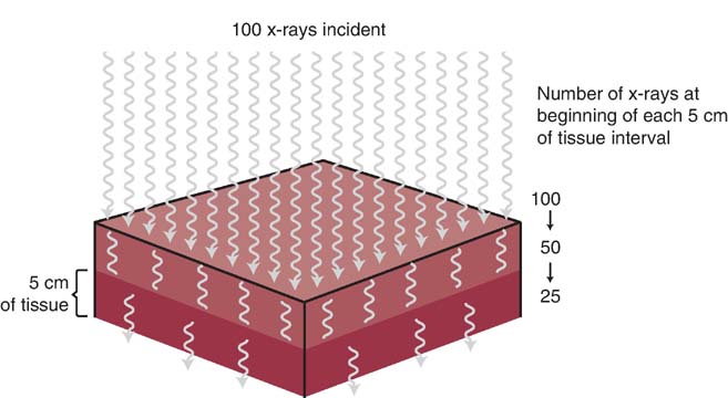 Radiographic Imaging and Exposure